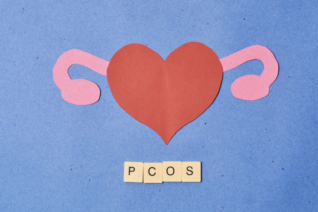 Polycystic Ovarian Syndrome (PCOS) & Endometriosis Symptoms - Pelvic ...